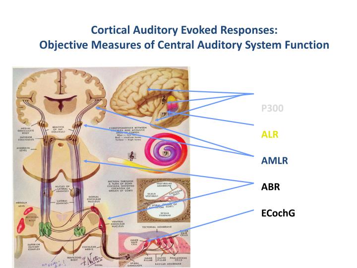 PPT - Auditory Steady State Responses (ASSRs): Pros and Cons for ...