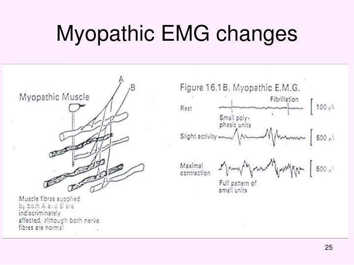 PPT - ELECTROMYOGRAPHY AND MOTOR NERVE CONDUCTION VELOCITY PowerPoint ...