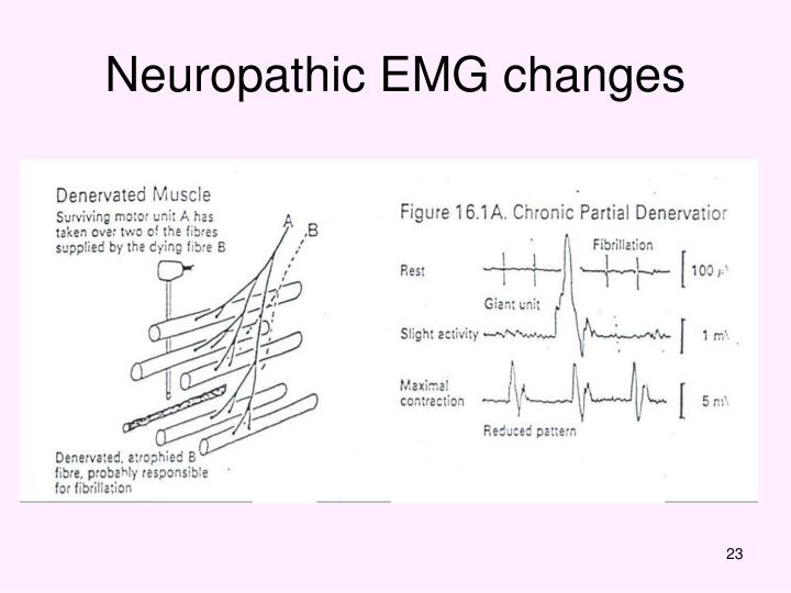 PPT - ELECTROMYOGRAPHY AND MOTOR NERVE CONDUCTION VELOCITY PowerPoint ...