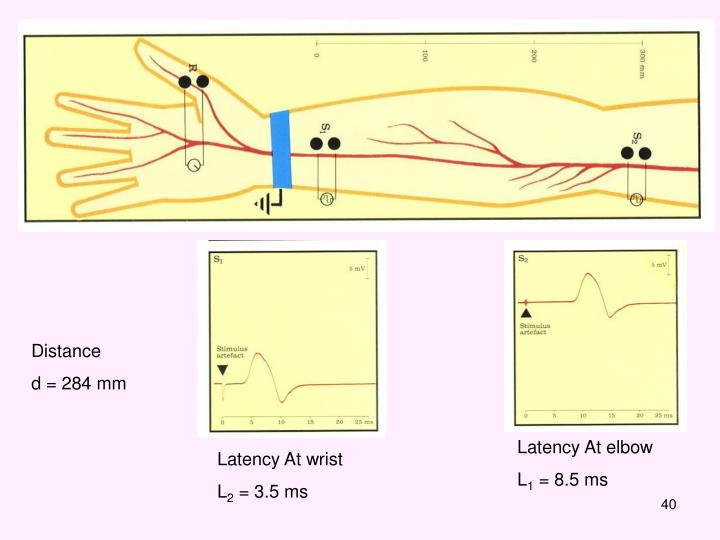 PPT - ELECTROMYOGRAPHY AND MOTOR NERVE CONDUCTION VELOCITY PowerPoint ...