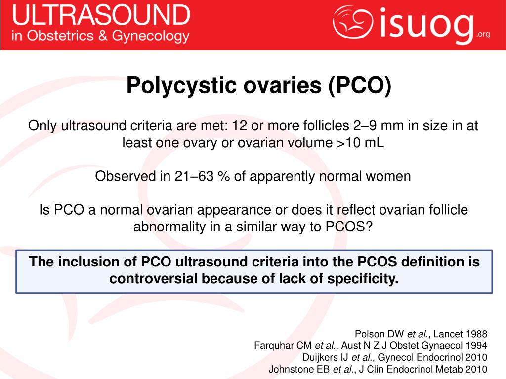 PPT - Polycystic ovaries at ultrasound: normal variant or silent ...