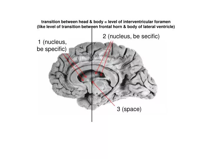 PPT - Head of caudate nucleus PowerPoint Presentation, free download ...