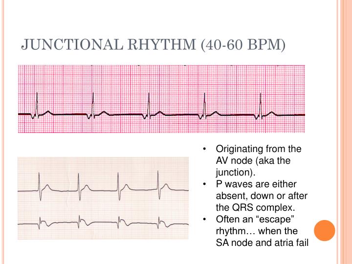 PPT - ELECTROPHYSIOLOGY PowerPoint Presentation - ID:6039396