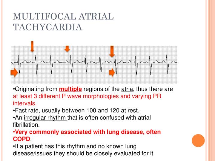 PPT - ELECTROPHYSIOLOGY PowerPoint Presentation - ID:6039396