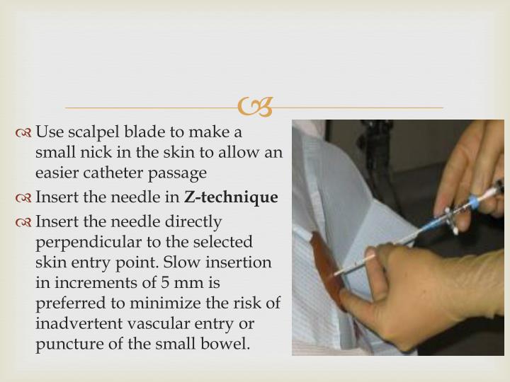 PPT - Abdominal paracentesis PowerPoint Presentation - ID:6039680