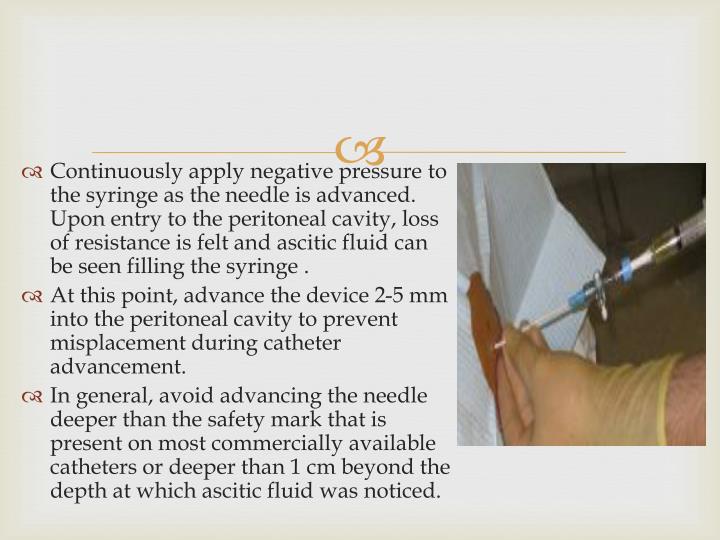 PPT - Abdominal paracentesis PowerPoint Presentation - ID:6039680