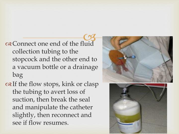PPT - Abdominal paracentesis PowerPoint Presentation - ID:6039680