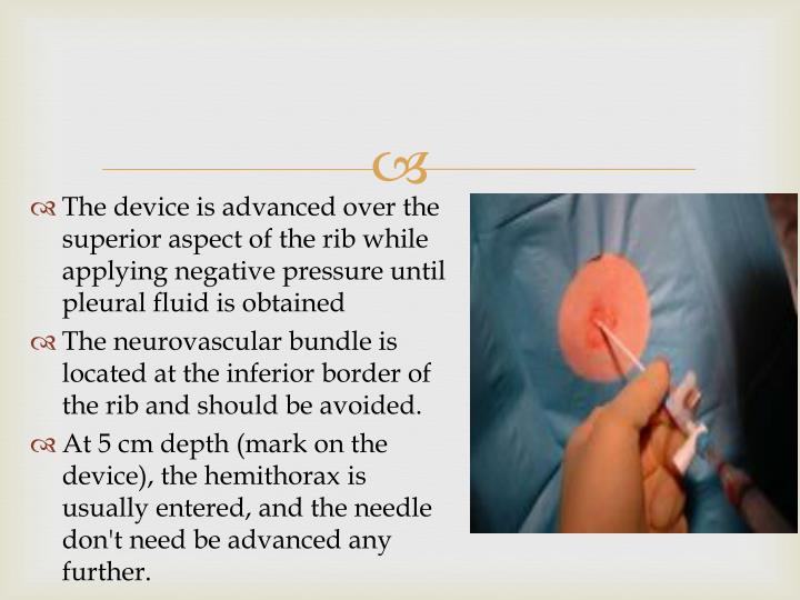 PPT - Abdominal paracentesis PowerPoint Presentation - ID:6039680