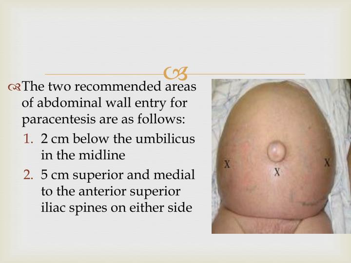 PPT - Abdominal paracentesis PowerPoint Presentation - ID:6039680