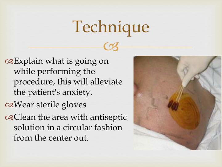 PPT - Abdominal paracentesis PowerPoint Presentation - ID:6039680