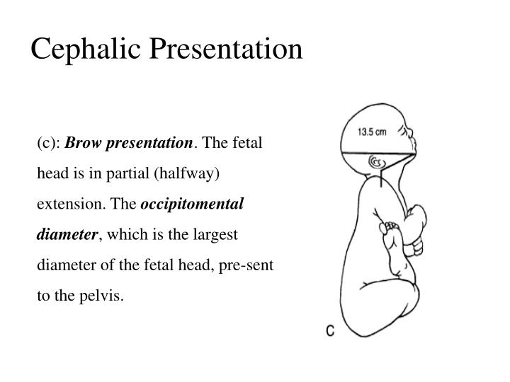 PPT - Chapter 22: processes and stages of labor and birth PowerPoint ...