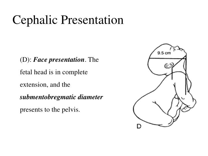 PPT - Chapter 22: processes and stages of labor and birth PowerPoint ...