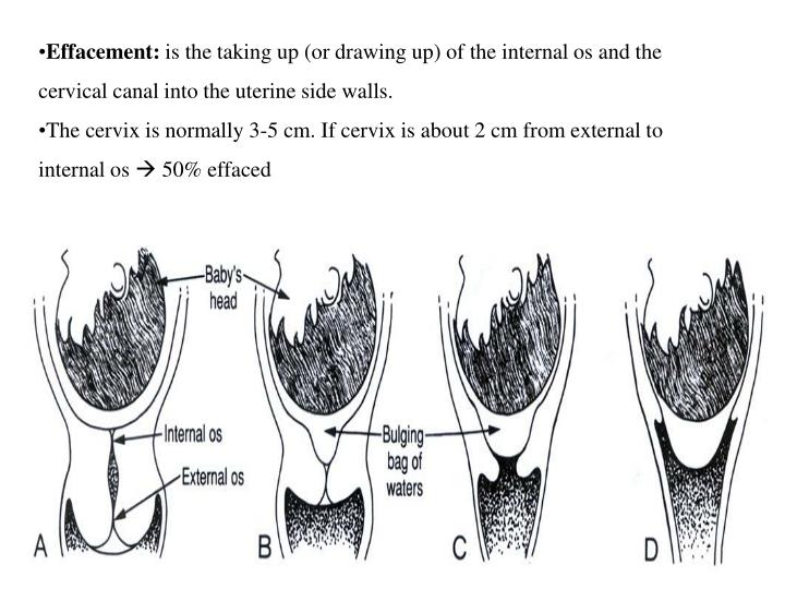 PPT - Chapter 22: processes and stages of labor and birth PowerPoint ...