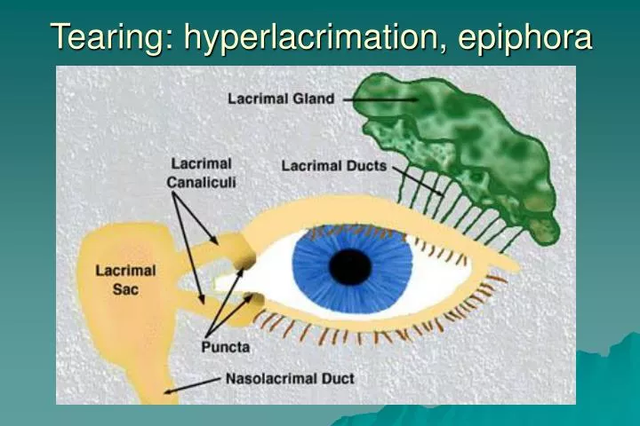 Ppt Tearing Hyperlacrimation Epiphora Powerpoint Presentation Free