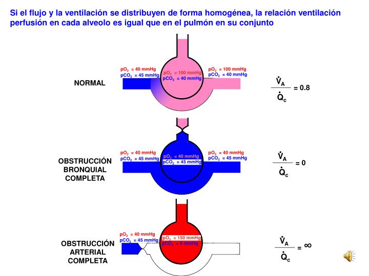 PPT - RELACIÓN VENTILACIÓN-PERFUSIÓN PULMONAR PowerPoint Presentation ...