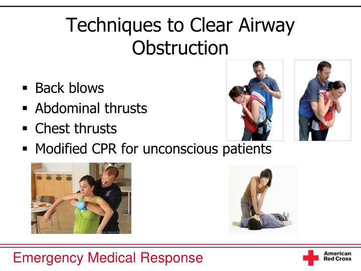 PPT - Airway and Ventilation PowerPoint Presentation - ID:6054096