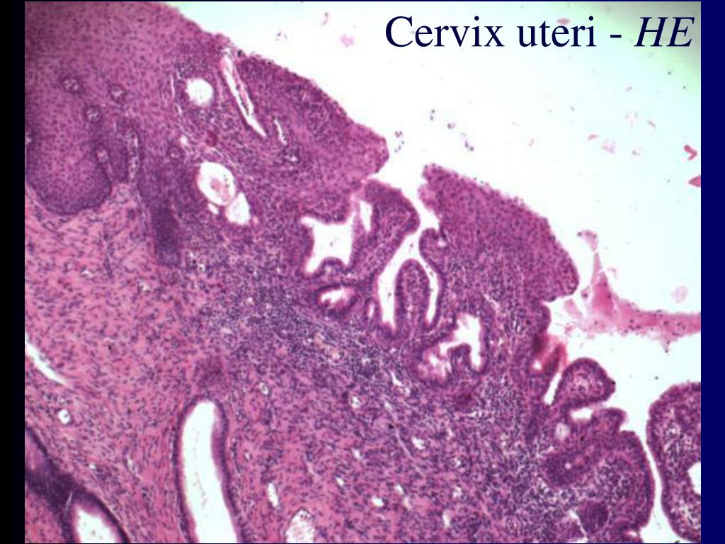 PPT - Systema genitale femininum Female genital system PowerPoint ...