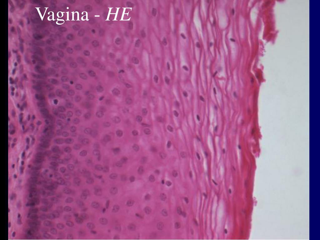 PPT - Systema genitale femininum Female genital system PowerPoint ...