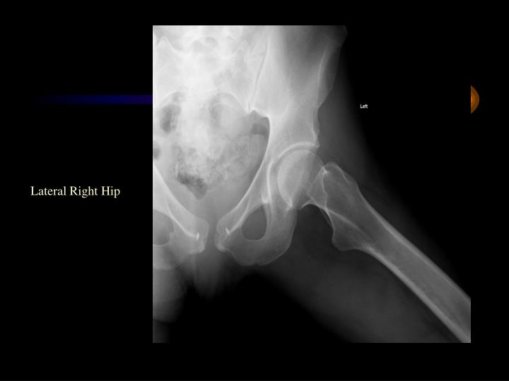 PPT - Pelvic Girdle PowerPoint Presentation - ID:6062924