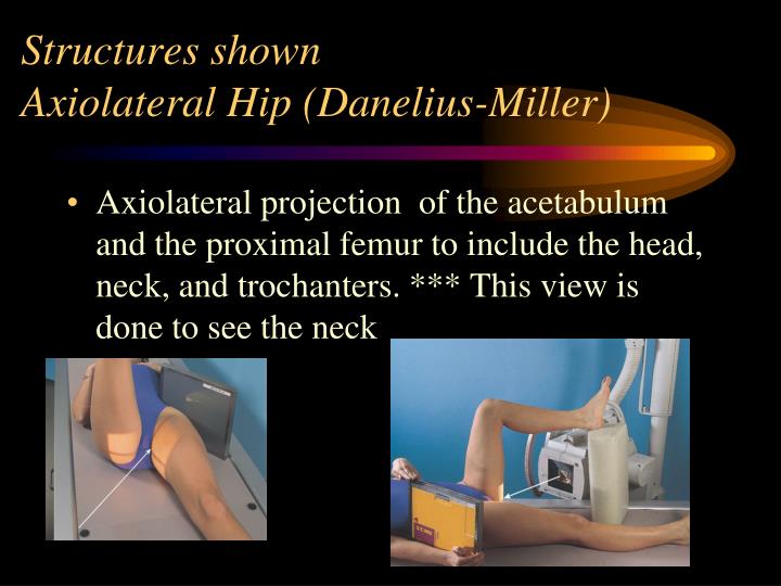 PPT - Pelvic Girdle PowerPoint Presentation - ID:6062924