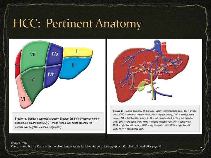 PPT - Understanding Hepatocellular Carcinoma (HCC) - A General Intro to ...