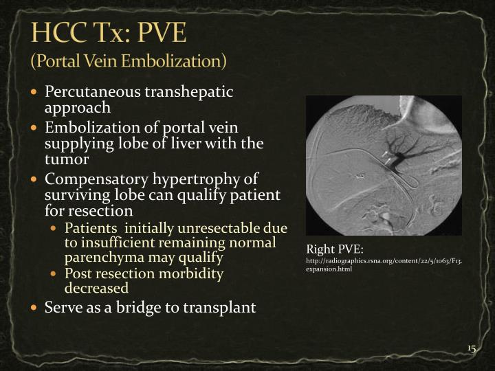 PPT - Understanding Hepatocellular Carcinoma (HCC) - A General Intro to ...