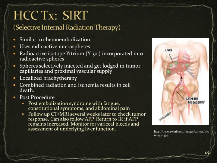 PPT - Understanding Hepatocellular Carcinoma (HCC) - A General Intro to ...