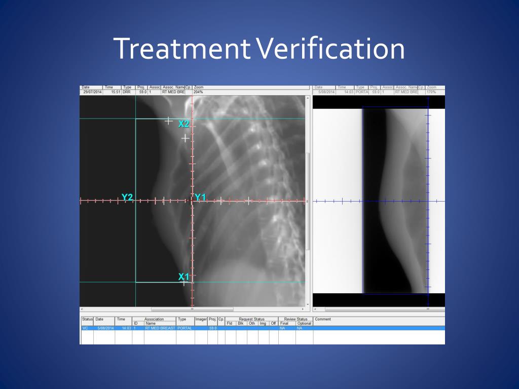 PPT - Radiation Therapy: The Breast Cancer Patient Experience ...