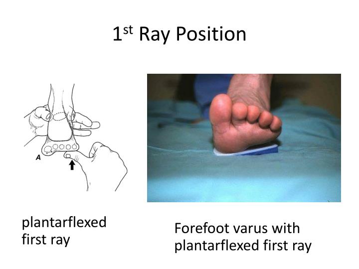PPT - Biomechanical Examination PowerPoint Presentation - ID:6066847