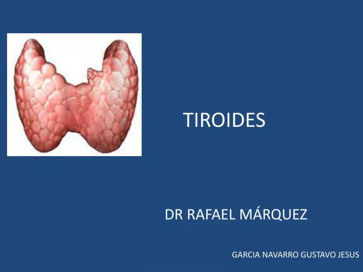 PPT - TIROIDES PowerPoint Presentation, free download - ID:6073243