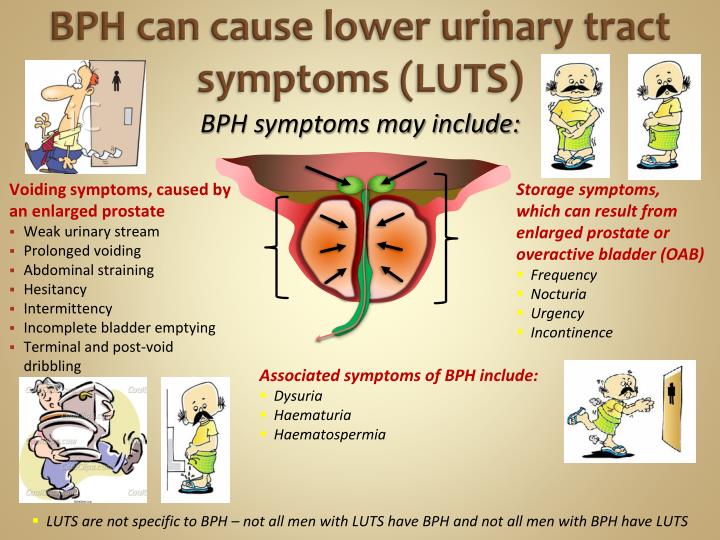 PPT - Current Strategic on BPH Management – Combination Therapy ...