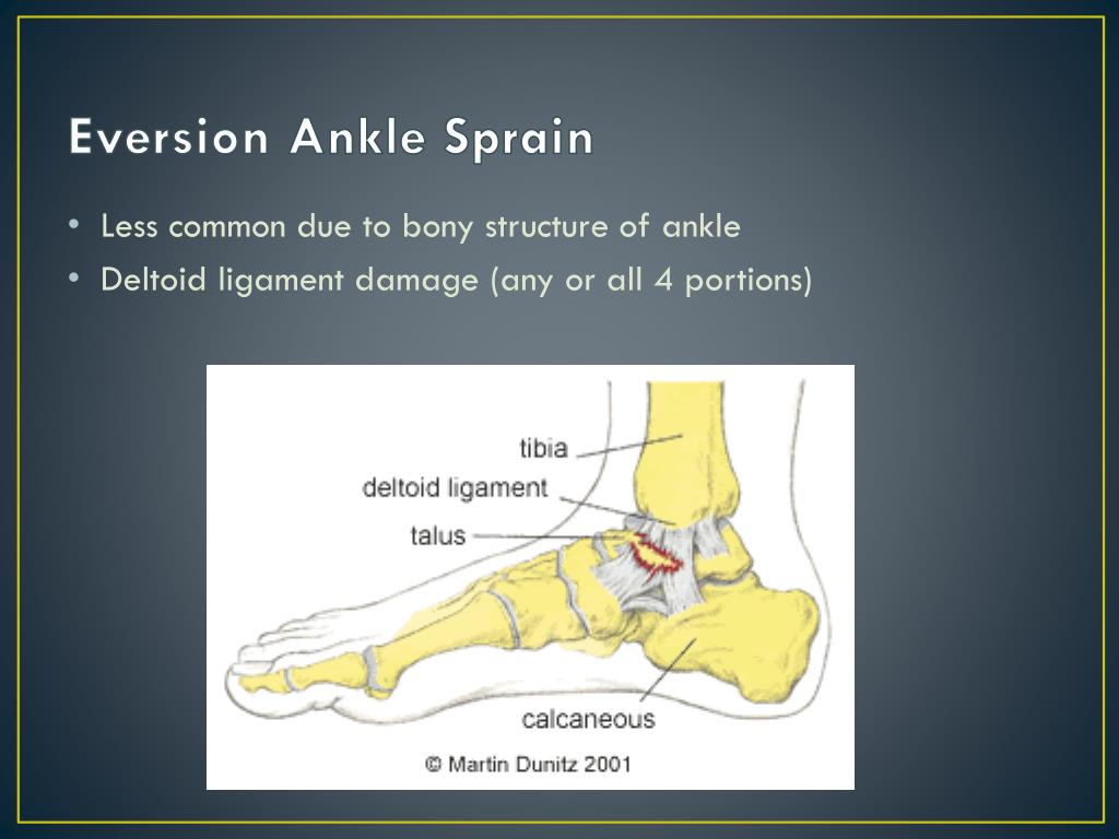 PPT - Injuries to the Foot, Ankle and Lower Leg PowerPoint Presentation ...