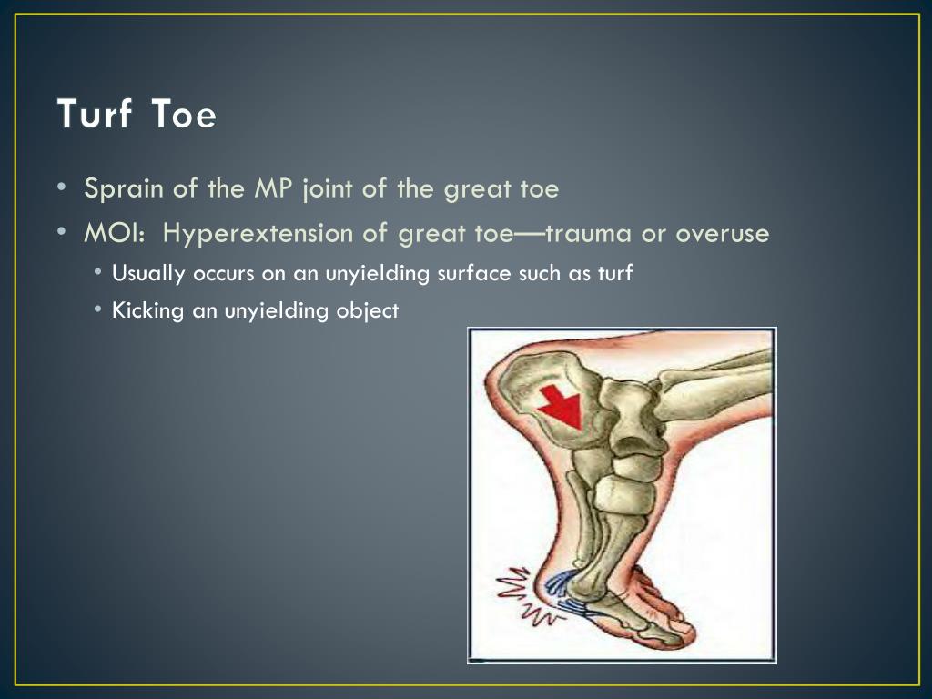 PPT - Injuries to the Foot, Ankle and Lower Leg PowerPoint Presentation ...