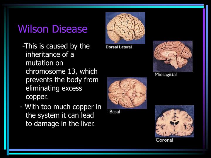 PPT - The Nervous System PowerPoint Presentation - ID:6083751