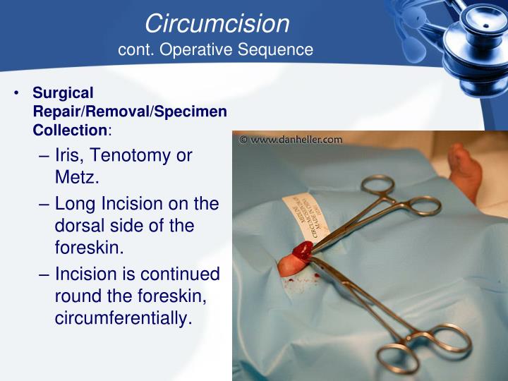 PPT - GU Procedures Operative Sequence PowerPoint Presentation - ID:6084441