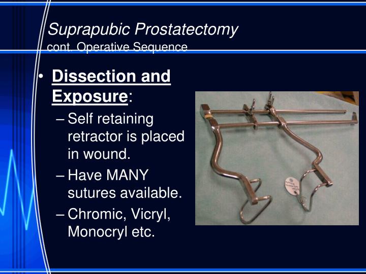 PPT - GU Procedures Operative Sequence PowerPoint Presentation - ID:6084441
