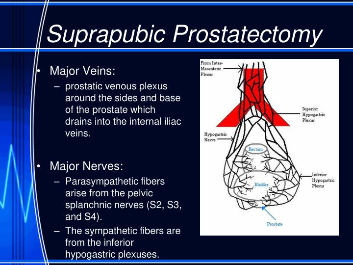 PPT - GU Procedures Operative Sequence PowerPoint Presentation - ID:6084441