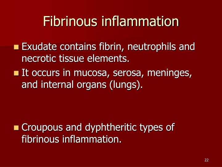 PPT - I N F L A M M A T I O N PowerPoint Presentation - ID:6085129