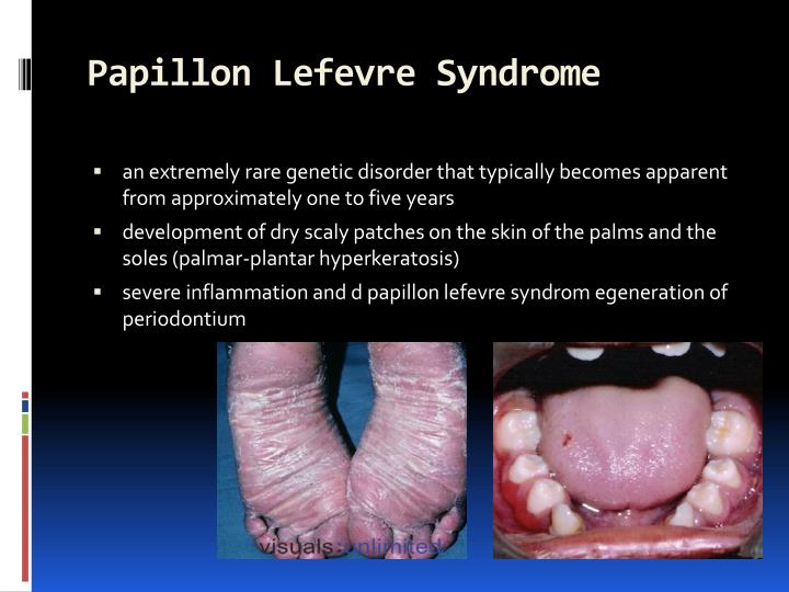 PPT - Case presentation PowerPoint Presentation - ID:6085897