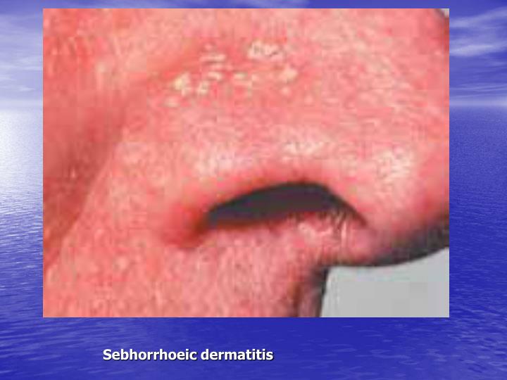 PPT - HIV in Primary Care PowerPoint Presentation - ID:6086883