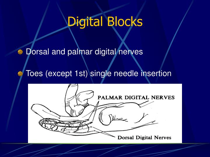 PPT - Nerve Blocks PowerPoint Presentation - ID:6088129