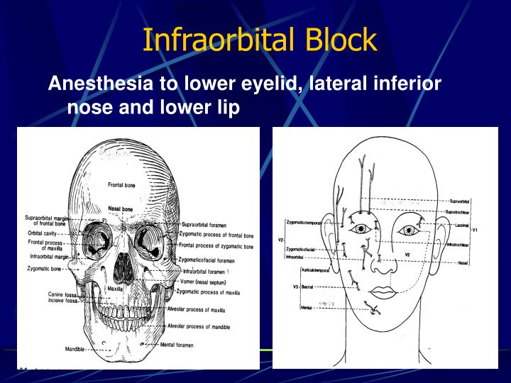PPT - Nerve Blocks PowerPoint Presentation - ID:6088129
