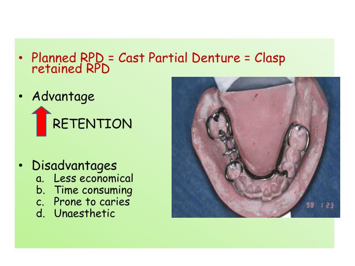 PPT - INTRODUCTION - REMOVABLE PARTIAL DENTURE PowerPoint Presentation ...