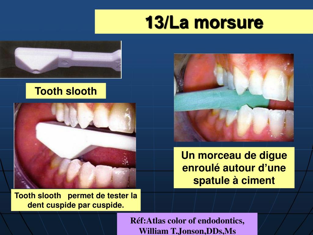 PPT - Moyens et CONDUITE DIAGNOSTIQUE EN ODONTOLOGIE CONSERVATRICE ...