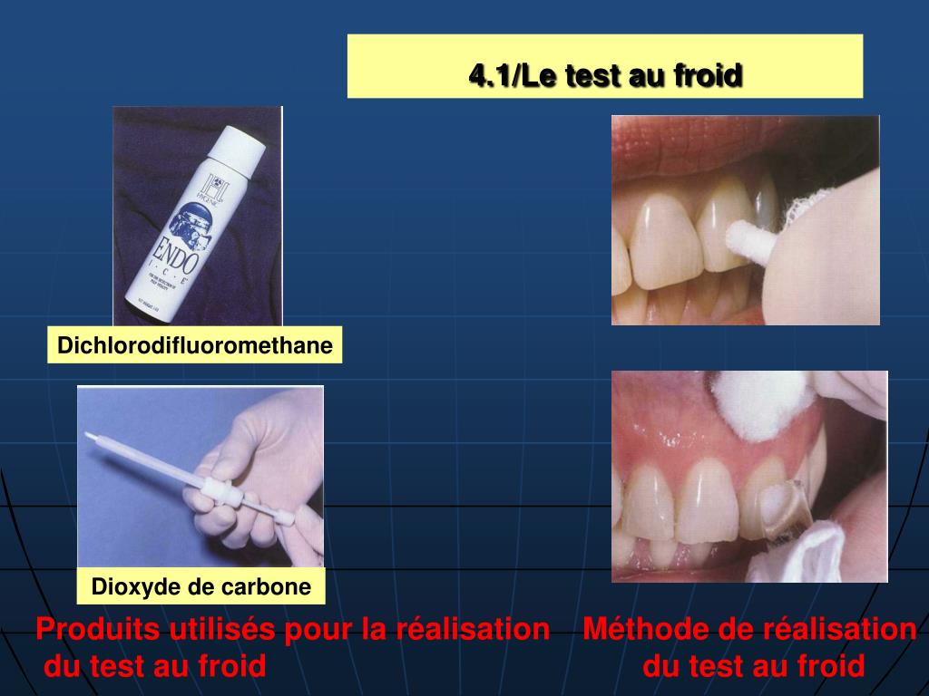 PPT - Moyens et CONDUITE DIAGNOSTIQUE EN ODONTOLOGIE CONSERVATRICE ...