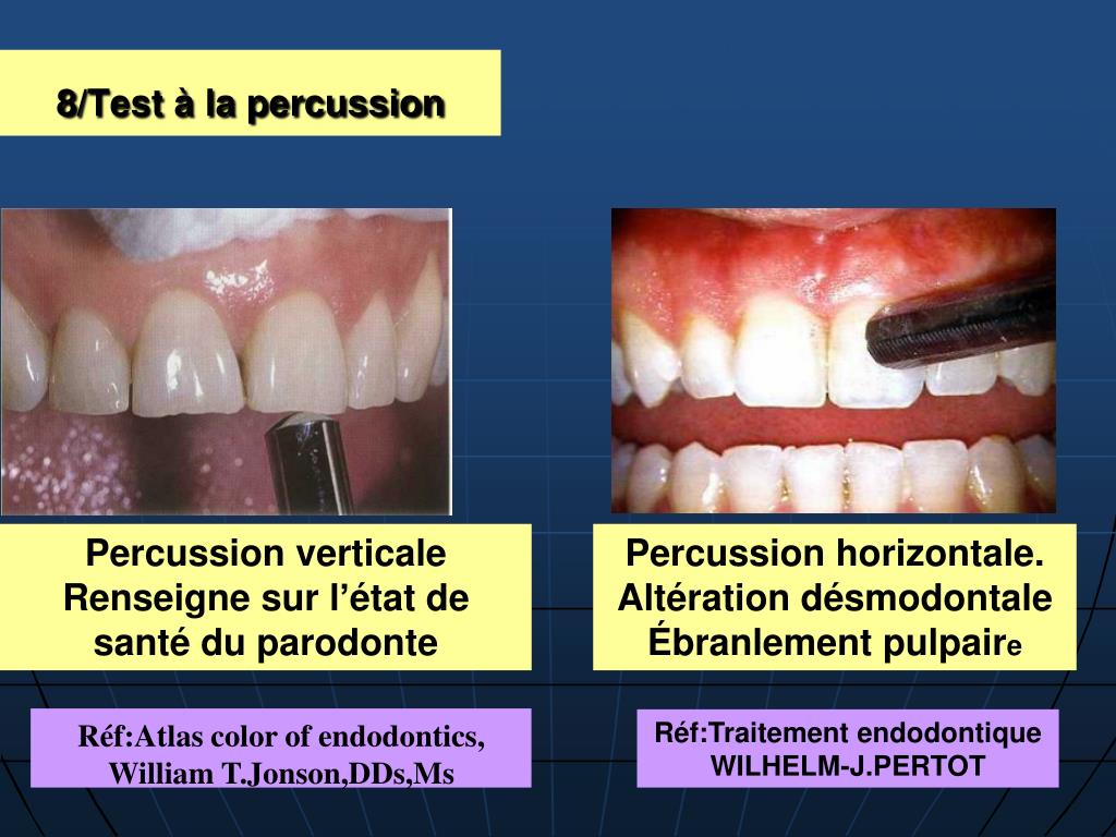 PPT - Moyens et CONDUITE DIAGNOSTIQUE EN ODONTOLOGIE CONSERVATRICE ...