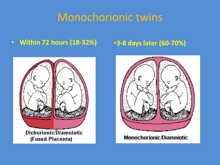 PPT - Multifetal Pregnancy PowerPoint Presentation - ID:6093454