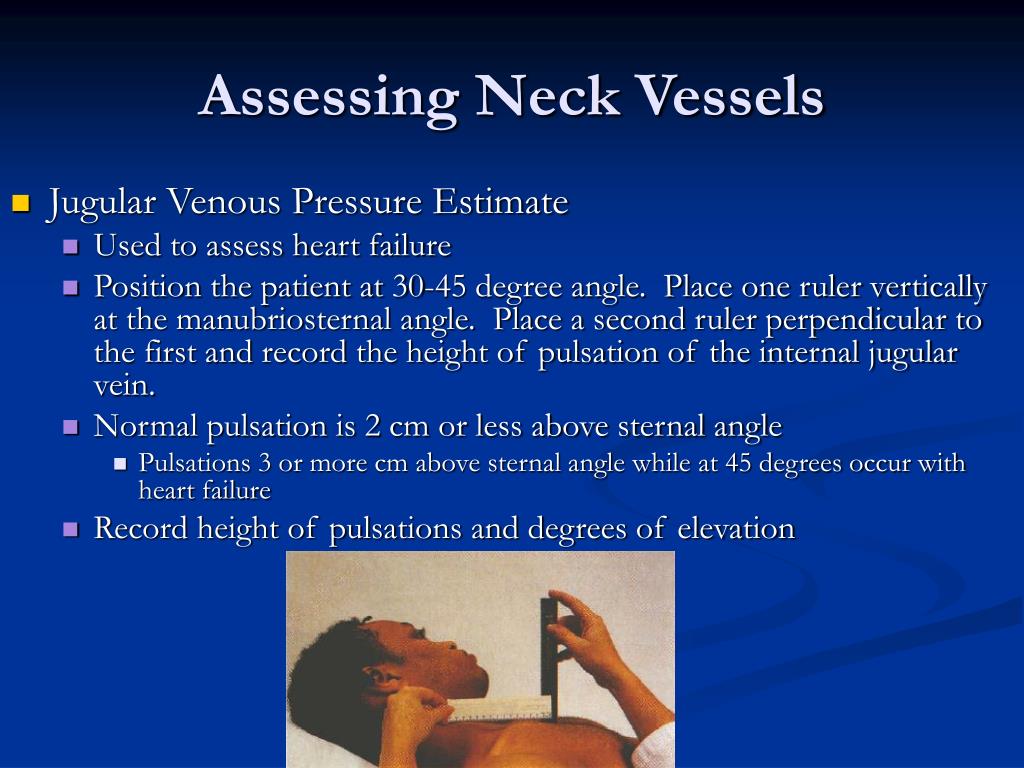 PPT - Heart and Neck Vessels PowerPoint Presentation, free download ...