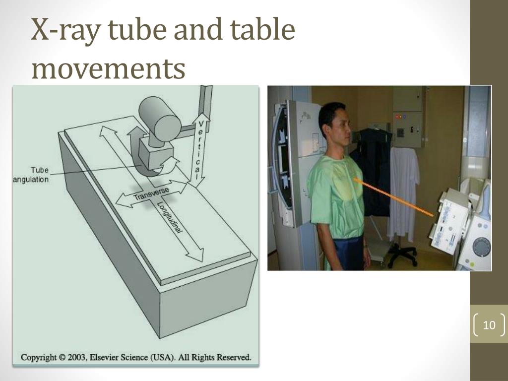 PPT - Radiation and Fluoroscopic Equipment PowerPoint Presentation ...