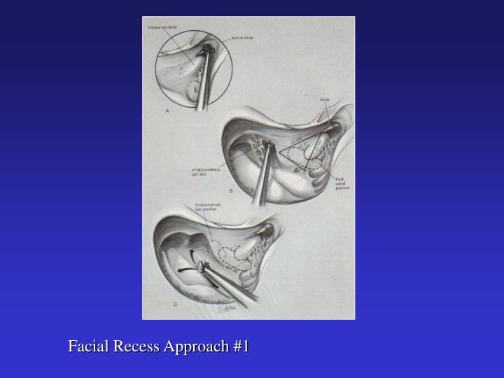 PPT - Cortical Mastoidectomy and Combined Approach Tympanoplasty (CAT ...